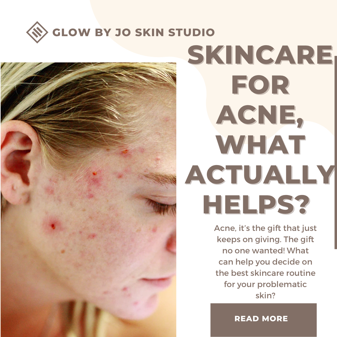 Skincare for Acne, What Actually Helps? – Glow by Jo Skin Studio